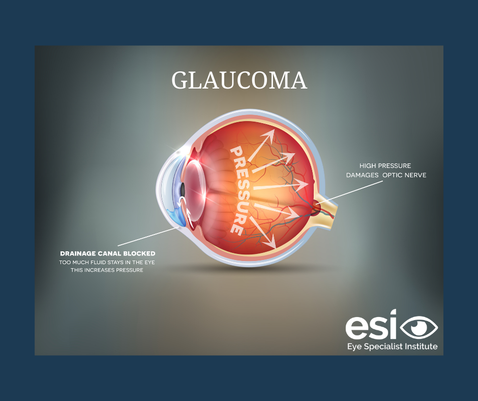 Glaucoma Vision Loss and Treatments | Eye Specialist Institute